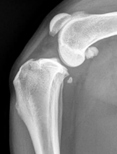 TPLO – Colorado Canine Orthopedics